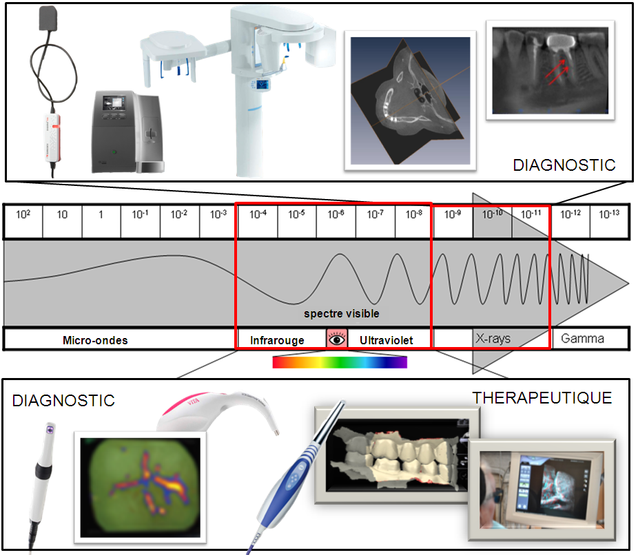 Le Cone Beam CT : évolution et révolution | Chirurgiens dentistes en France