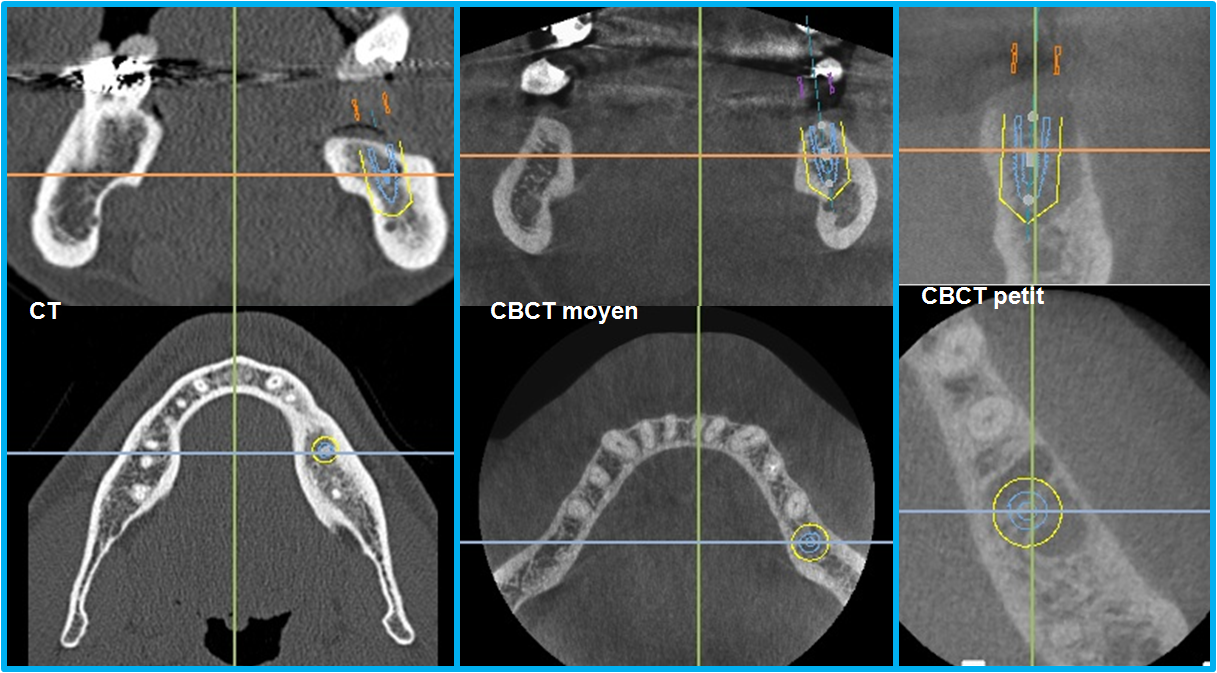 Le Cone Beam CT : évolution et révolution | Chirurgiens dentistes en France