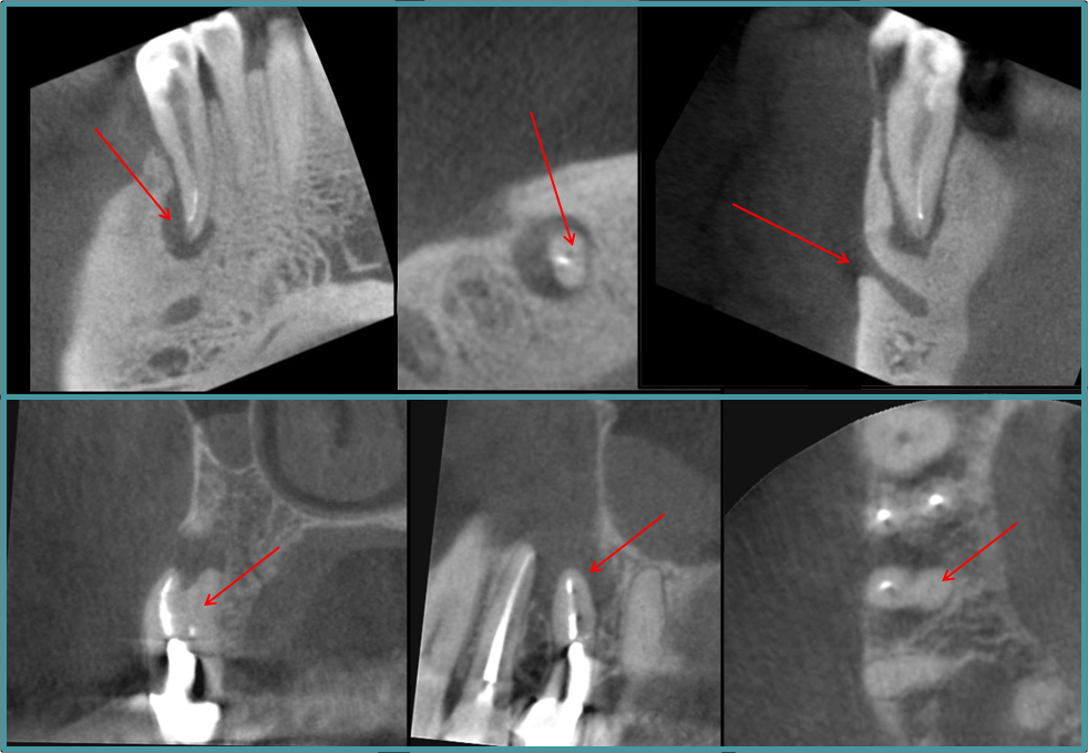 Le Cone Beam CT : évolution et révolution | Chirurgiens dentistes en France