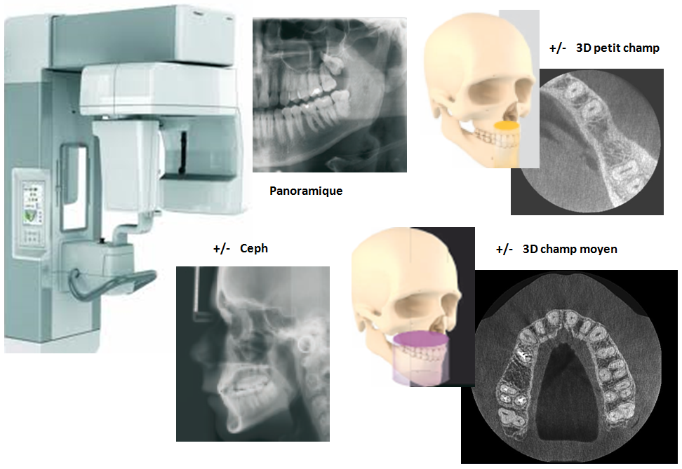 Le Cone Beam CT : évolution et révolution | Chirurgiens dentistes en France
